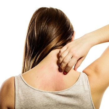 Dry Skin Causes & Treatment | Push Doctor