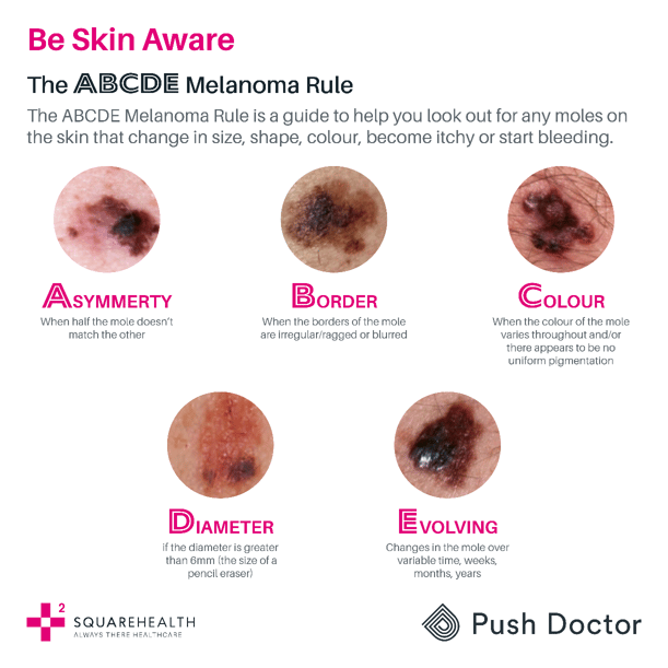 Sun Awareness Week – how to protect yourself from the sun to reduce ...